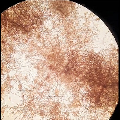 Bioculture For Wastewater Treatment | Greencraft Labs